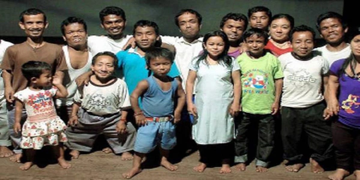Village of Dwarves: भारत का एक ऐसा गांव जहां केवल रहते हैं बौने लोग ...